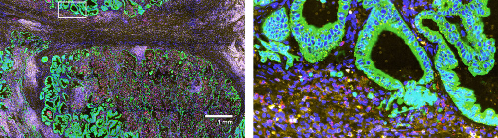 Cosmx Smi Overview Single Cell Imaging Nanostring