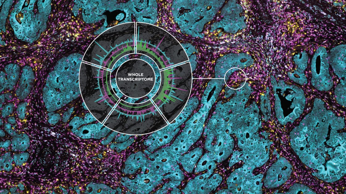 GeoMx® Cancer Transcriptome Atlas-Product Bulletin 日本語 | NanoString
