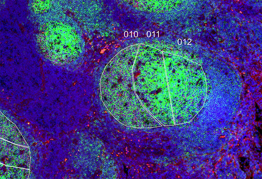 Explore Limitless Possibilities with Spatial Multiomics | NanoString