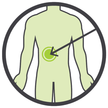 GeoMx DSP Spatial Genomics Overview - NanoString