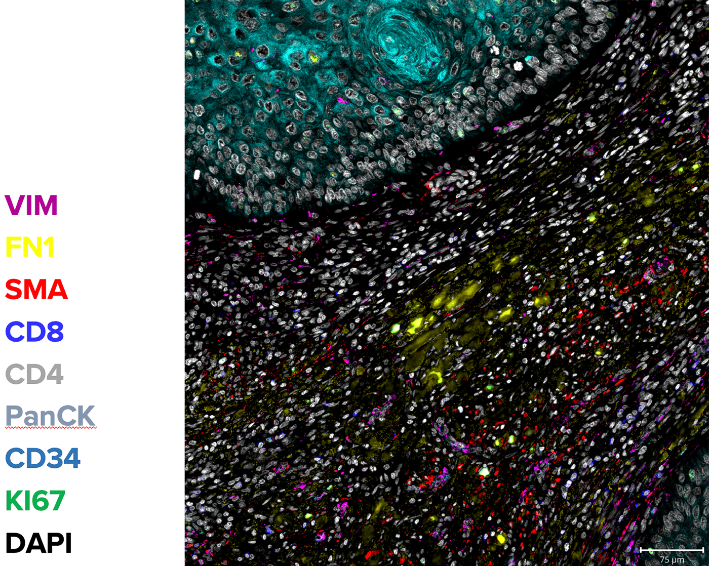 CosMx® Human Immuno-Oncology Protein Panel | NanoString