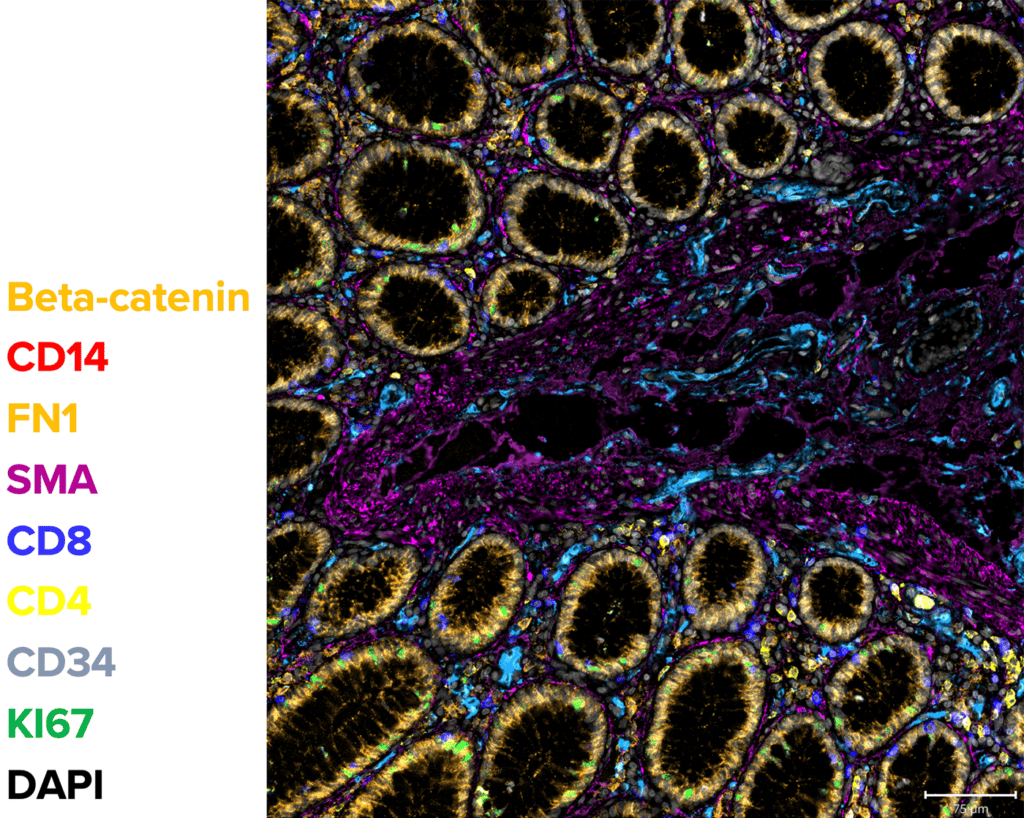CosMx® Human Immuno-Oncology Protein Panel | NanoString