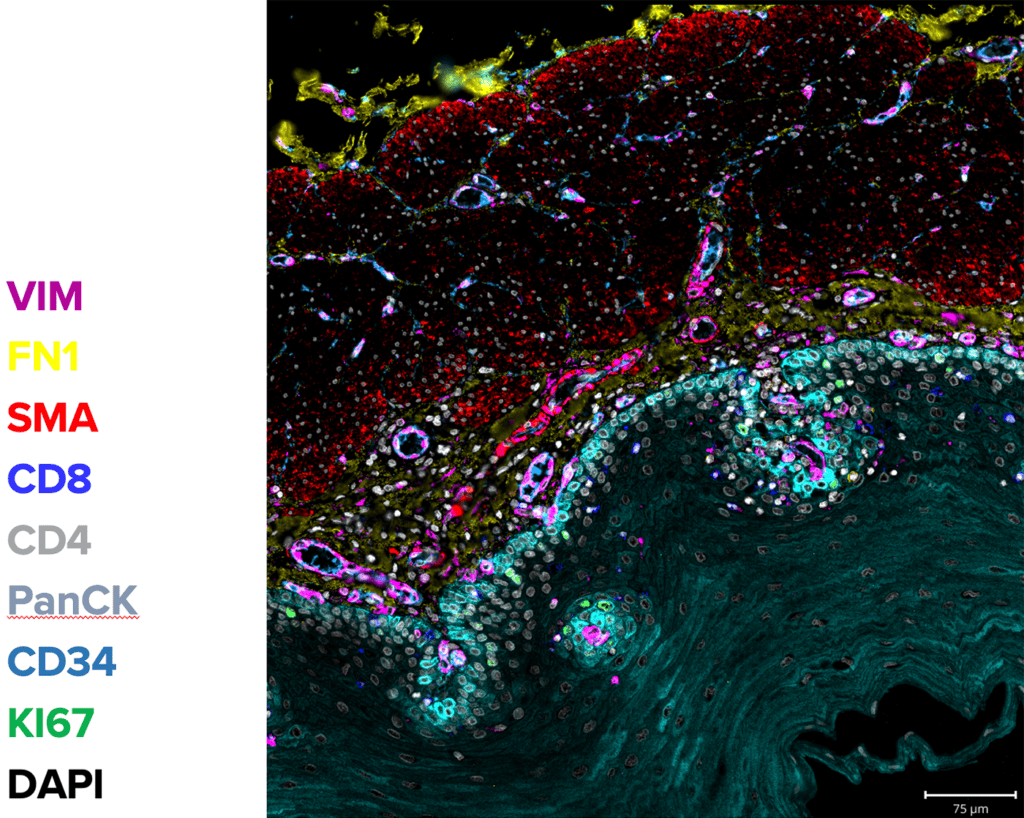 CosMx™ Human Immuno-Oncology Protein Panel | NanoString