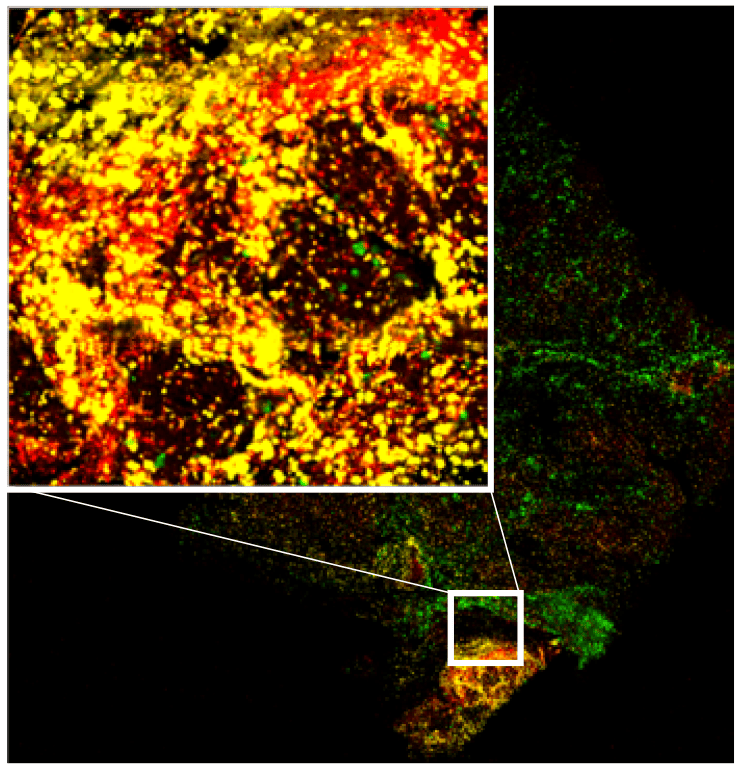 CosMx™ Universal Cell Characterization RNA Panel
