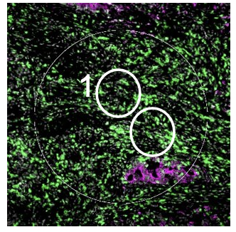 GeoMx DSP Spatial Genomics Overview - NanoString